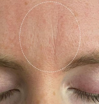 111SKIN Wrinkle Erasing Retinol Patches – 111SKIN – bluemercury