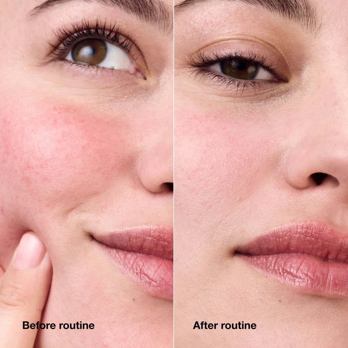 Clinique Redness Solutions Daily Relief Cream With Probiotic Technology ...