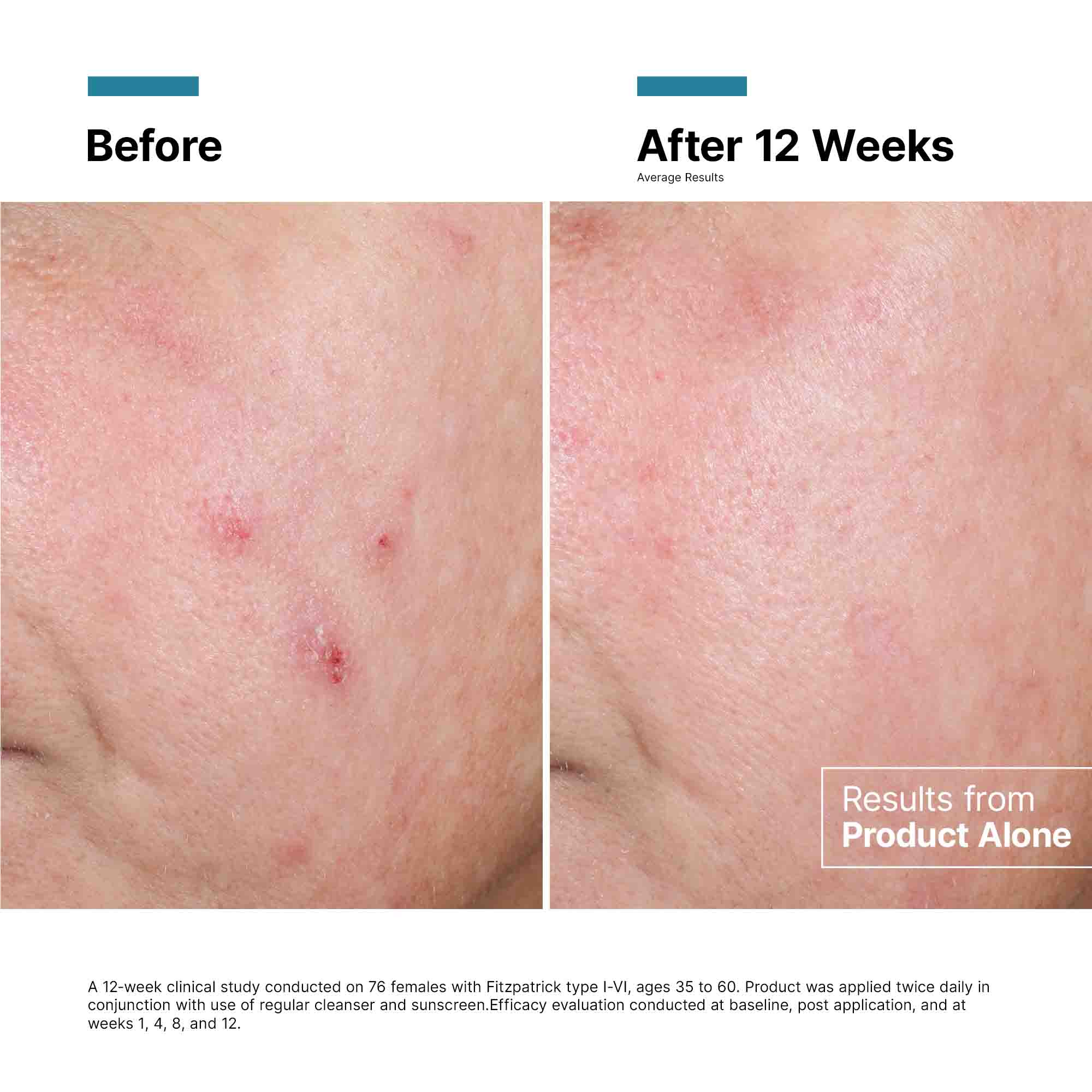 SkinCeuticals Advanced RGN-6 Regenerative Cream – SkinCeuticals ...