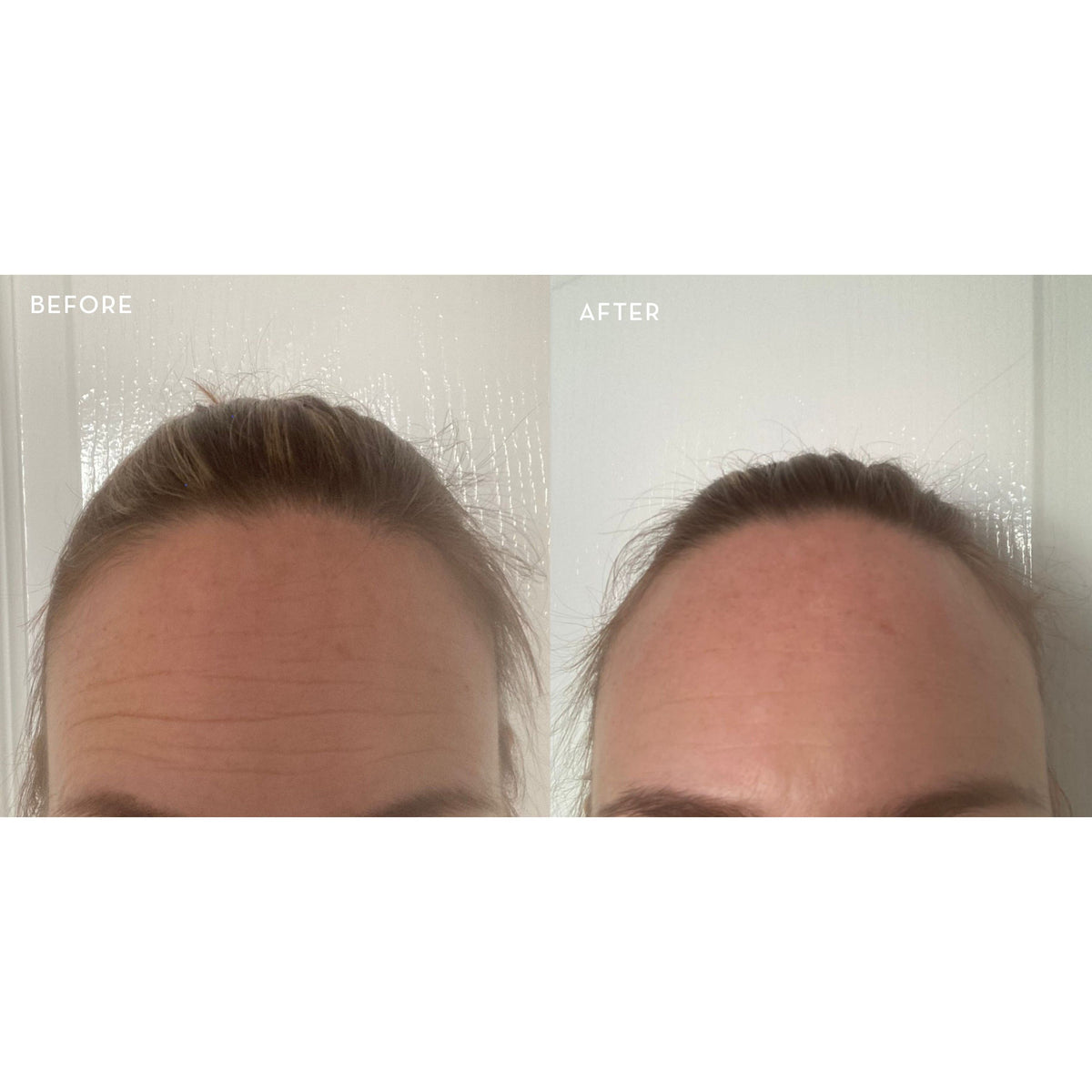 The Light Salon Boost LED Collar – The Light Salon – bluemercury