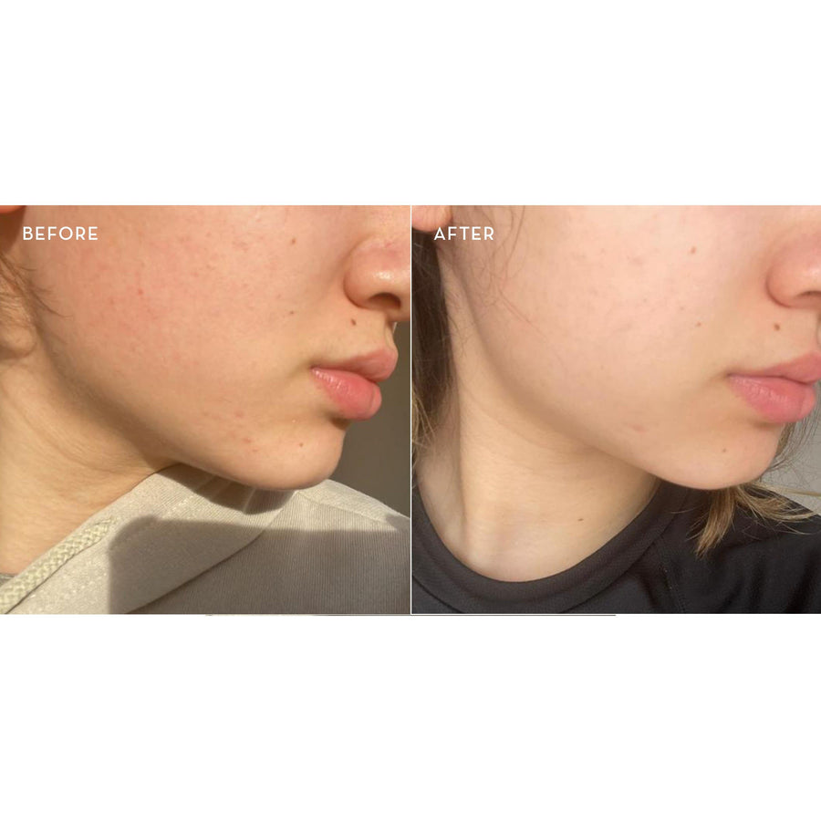 The Light Salon Boost LED Collar – The Light Salon – bluemercury